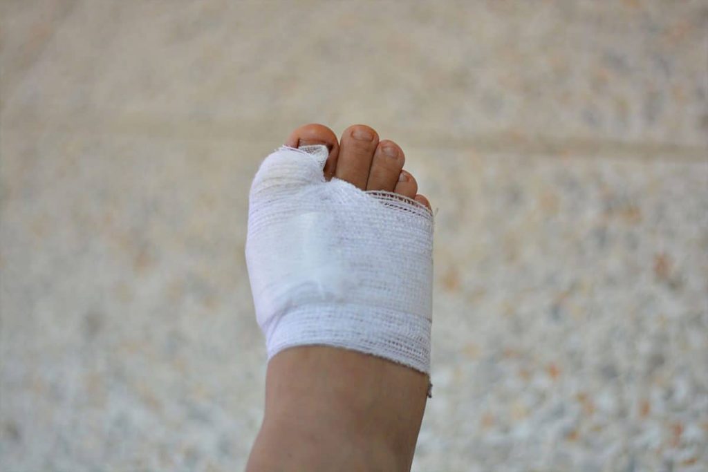 Ferida infeccionada: como identificar e tratar - Doutor Feridas