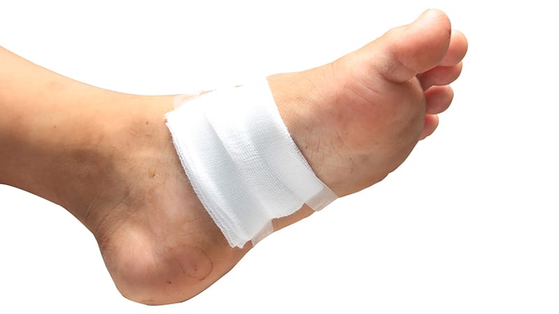 Ferida preta: o que é e como tratar - Doutor Feridas