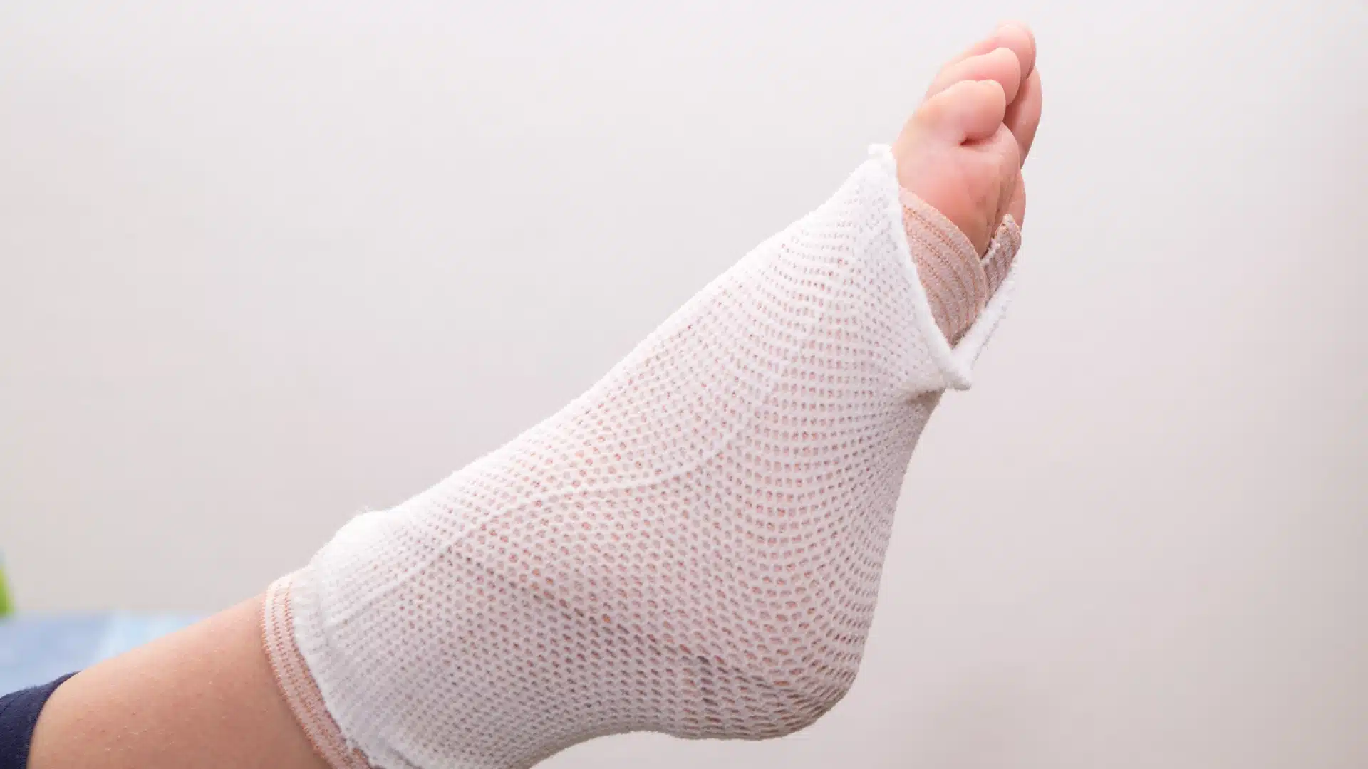 Úlcera infectada: o que é como tratar - Doutor Feridas